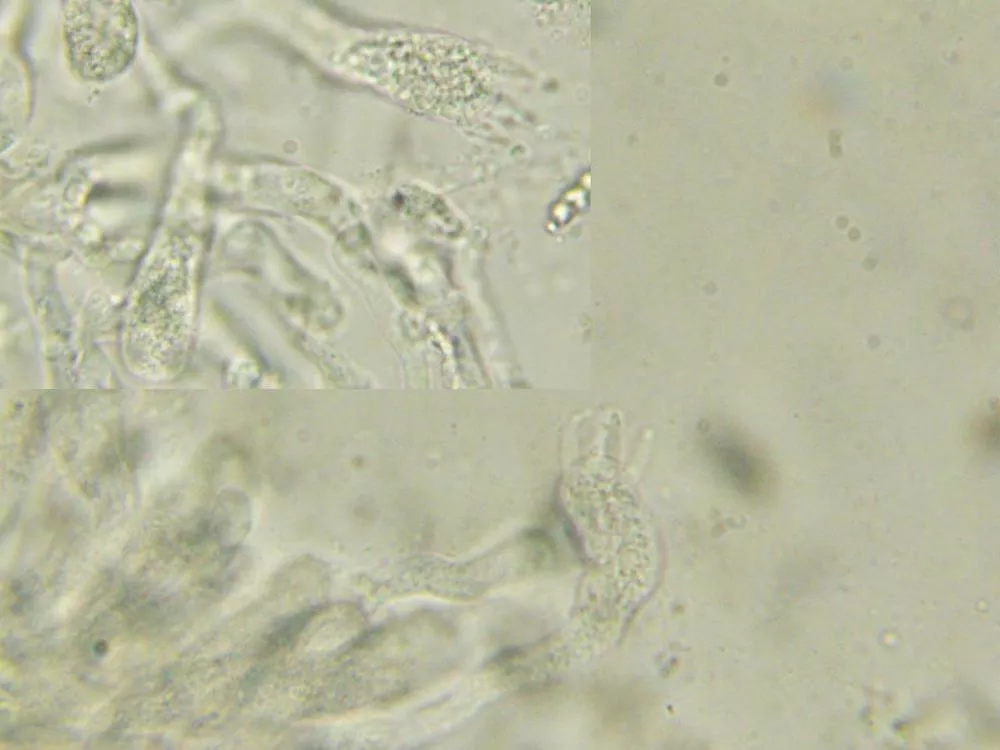 Polyporus Under A Microscope